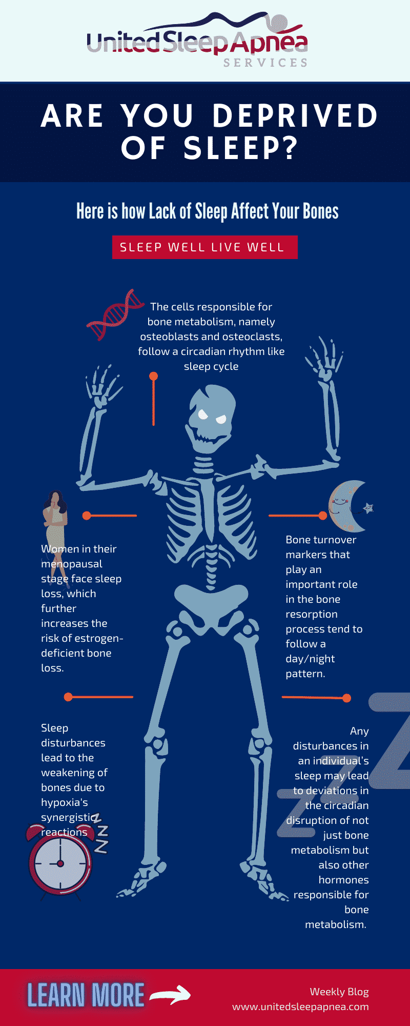 Bone Metabolism and Effects of Sleep Loss on Bone